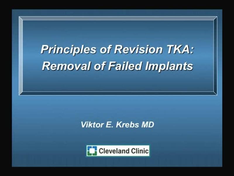 Kinematic Driven Alignment in TKA - Orthogate