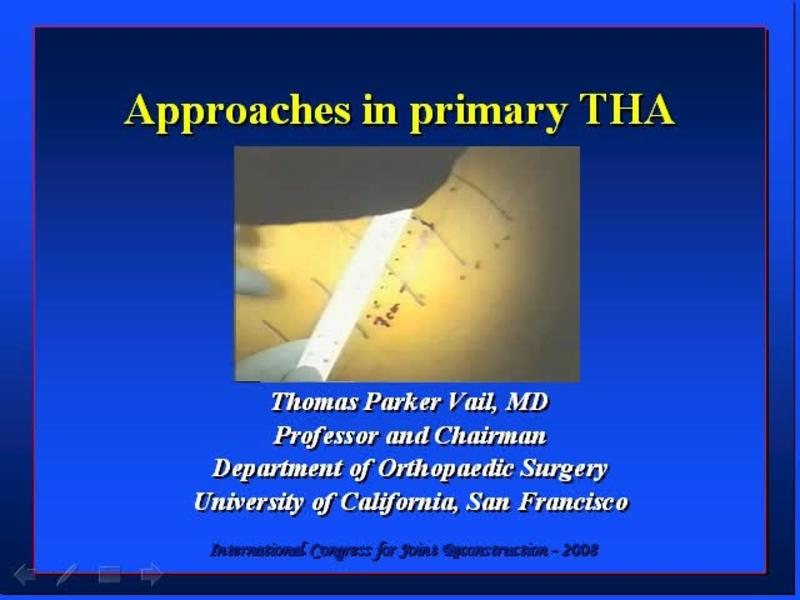 Approaches in Primary THA - Discussion - Orthogate
