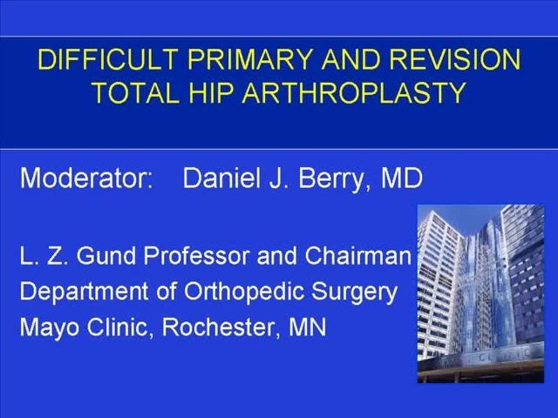 The Difficult THA - Case Presentations and Discussion - Orthogate
