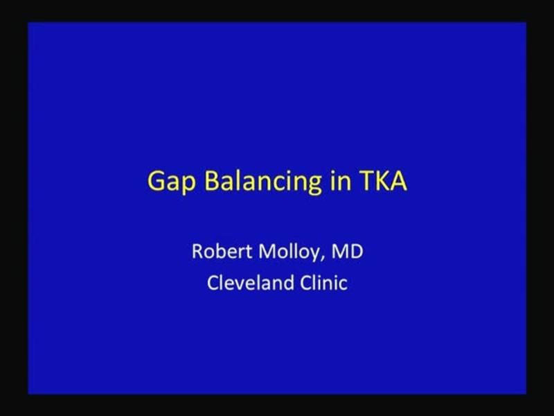 Gap Balancing in TKA - Orthogate