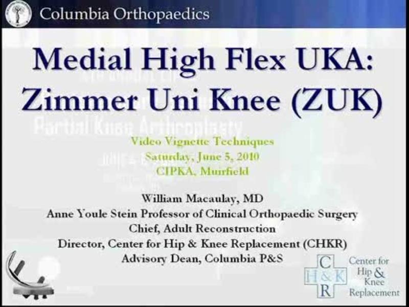 Medial High Flex UKA - Zimmer Uni Knee (ZUK) - Orthogate