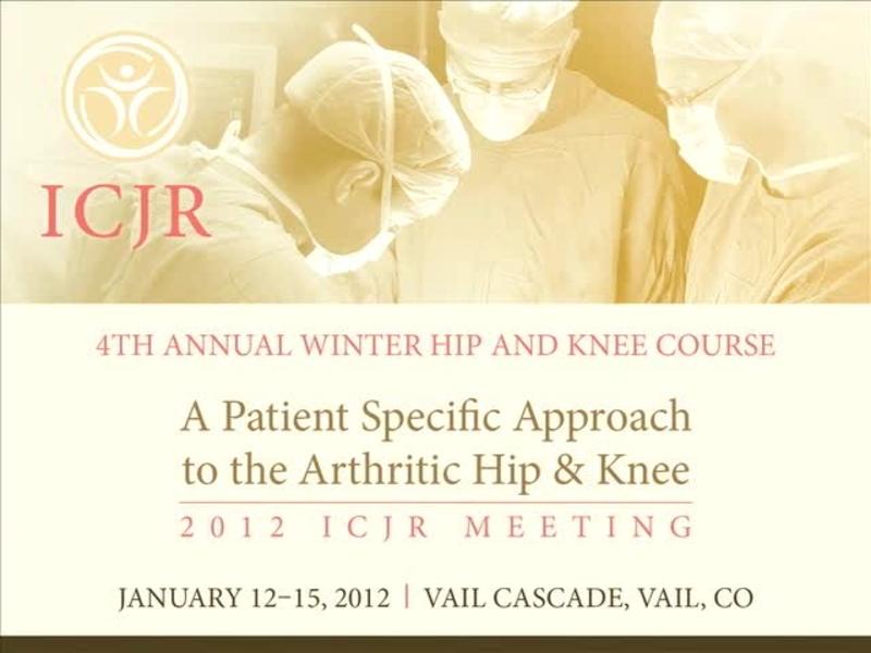 The Science Behind Gender Specific Total Knee Arthroplasty - Orthogate