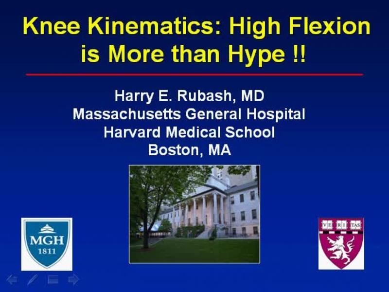 High Flexion TKA Is More Than Hype - Orthogate