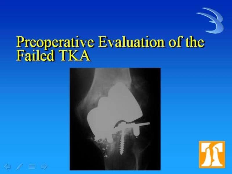 Orthopaedic Educational Videos - Orthopaedic Surgery Videos & Lectures ...