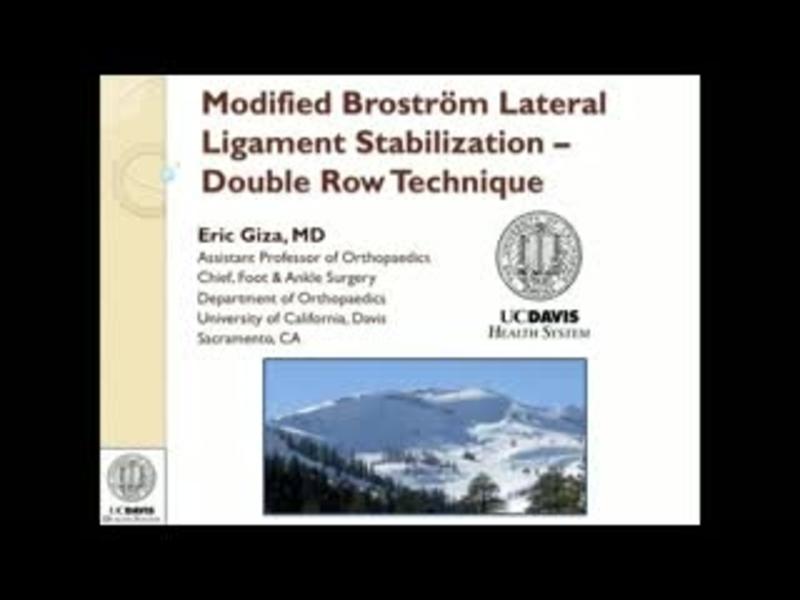 Modified Brostrom Lateral Ligament Stabilization by Dr. Eric - Orthogate